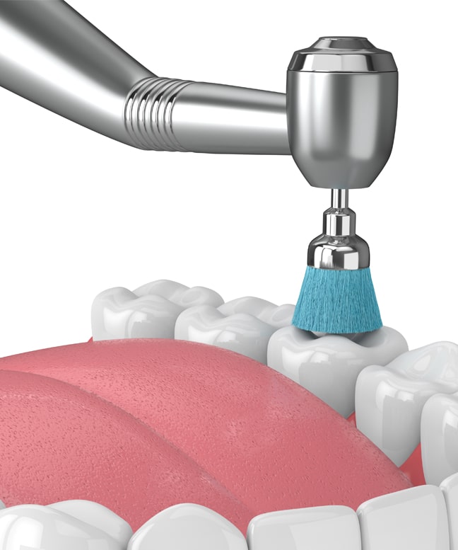 Denplan Essentials Advanced - St Mawes Dental